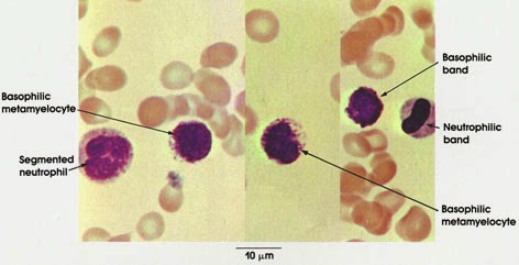 Hematologia: Serie Leucocitaria, Basófilos