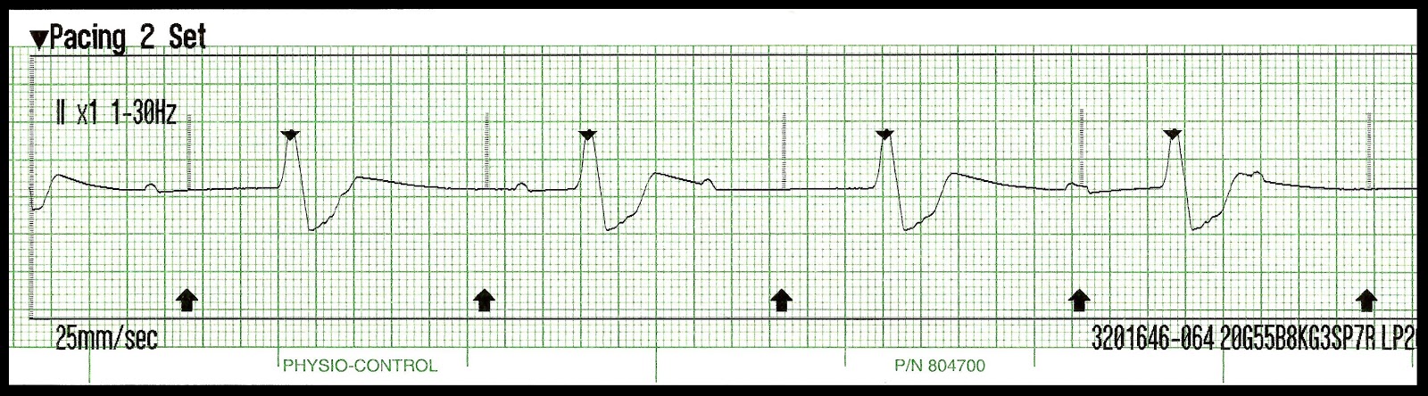 Float Nurse: ACLS review: Bradycardia Review Questions Part 3