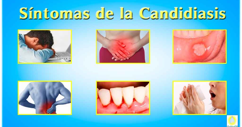 Candidiasis y diafragma: Candidiasis