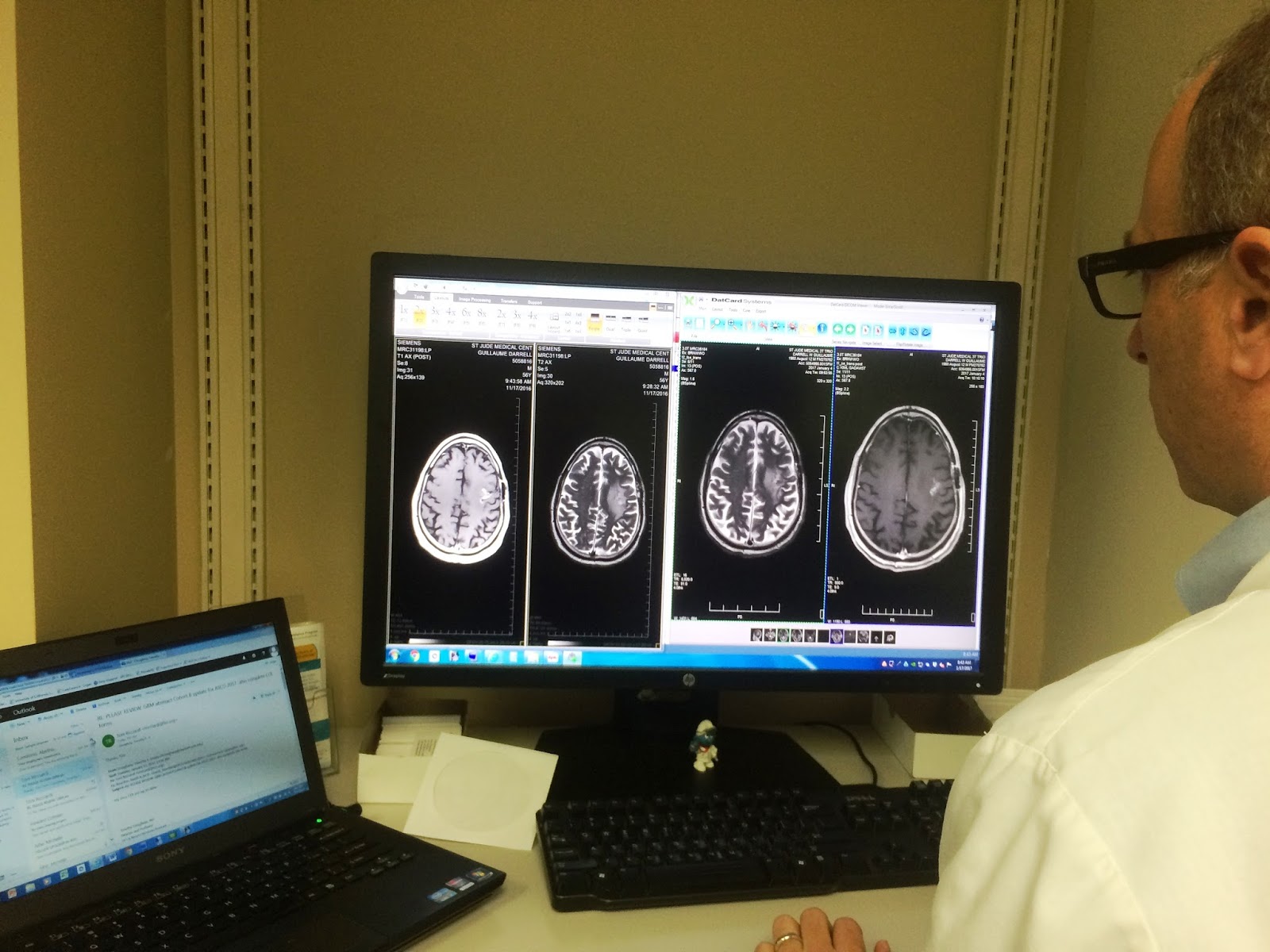 Brain cancer is...: Clear Scan Confirmed