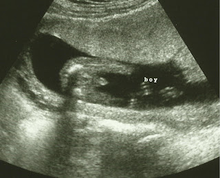 Discovering Your Own Stream ♥: 20 Week Ultrasound - Anatomy Scan
