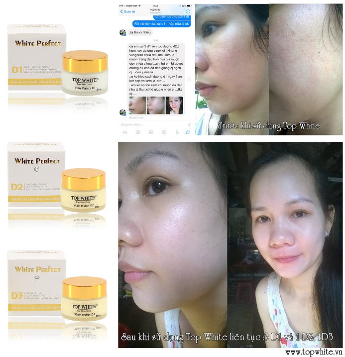 Mỹ phẩm Top White