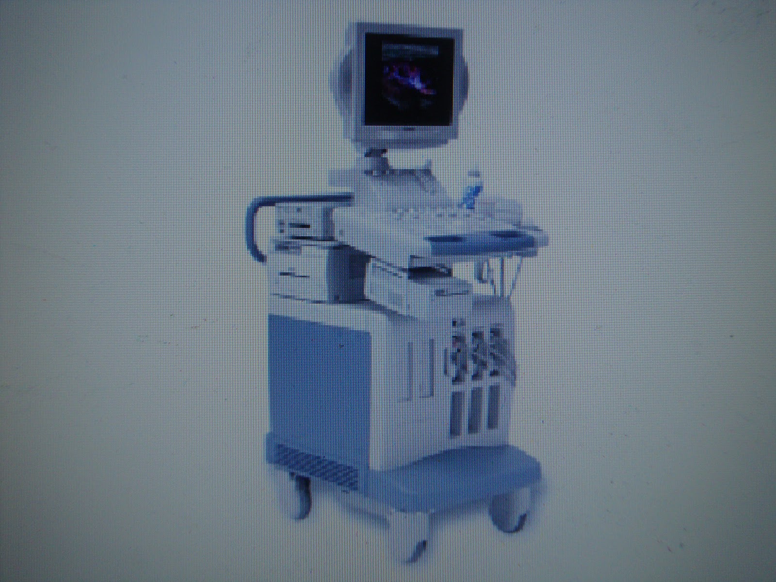 ultrasound machine: Toshiba Nemio XG ultrasound machine