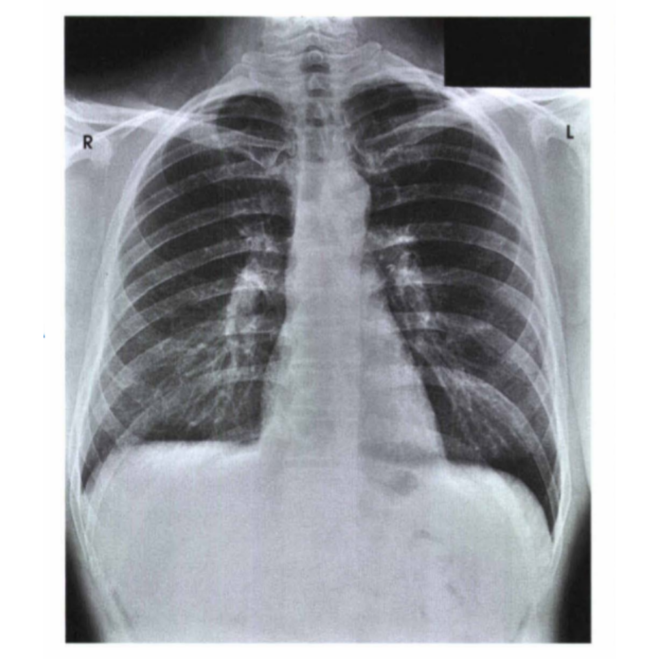 Gambaran radiograf terhadap posisi anatomi