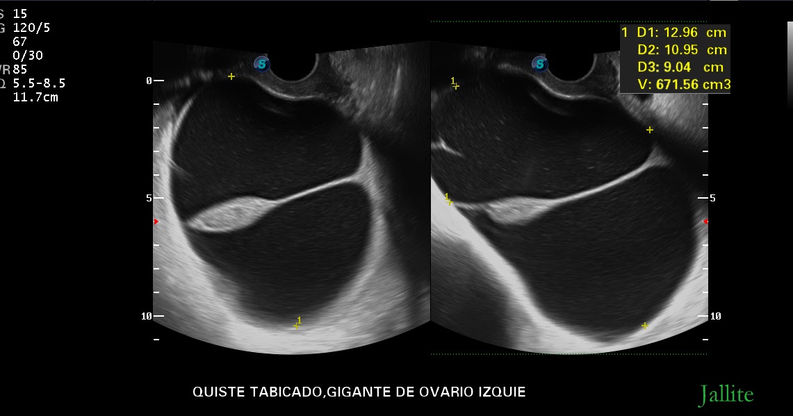 Diario de un Medico II