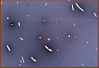 [Microbiology] Atlas of Negative Stain | Free Medical Atlas