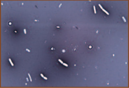 [Microbiology] Atlas of Negative Stain | Free Medical Atlas