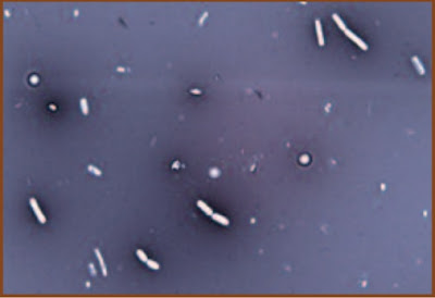 [Microbiology] Atlas of Negative Stain | Free Medical Atlas