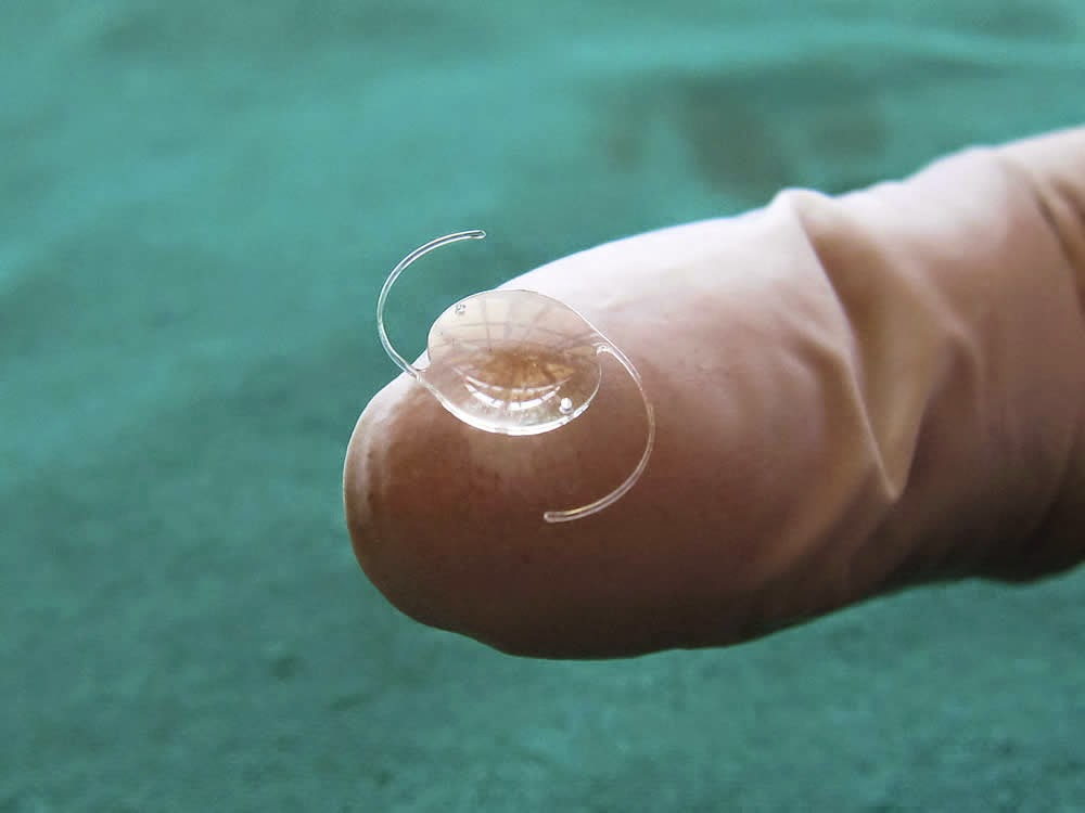 Pilihan Lensa Buatan Dalam Operasi Pengobatan Katarak