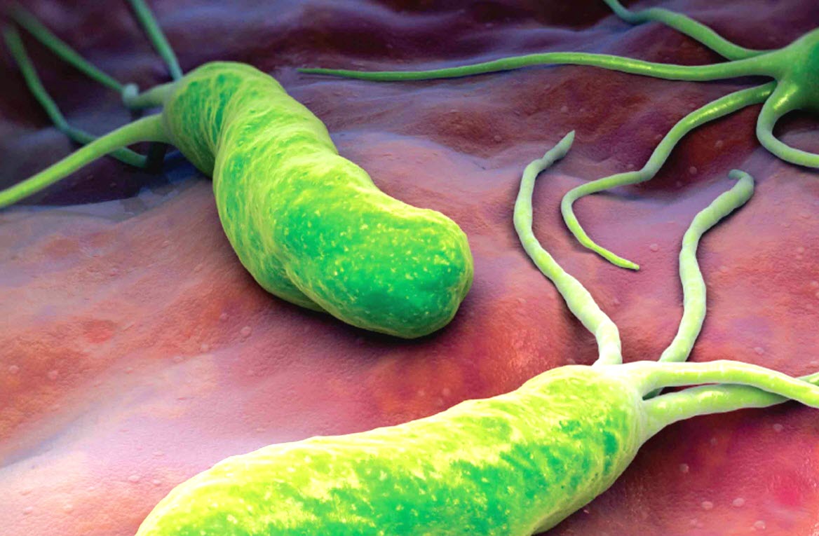 Seberapa Bahayakah Bakteri Helicobacter Pylori Bagi Penderita Lambung ...