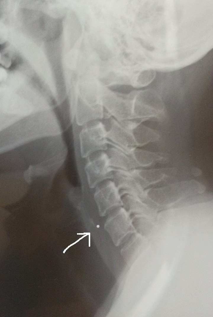 BABY TURTLE: Choking on a Fish Bone