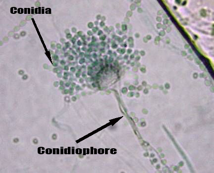 Fungal Structures and Mycology Terminologies Essential for ...