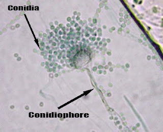 Fungal Structures and Mycology Terminologies Essential for ...