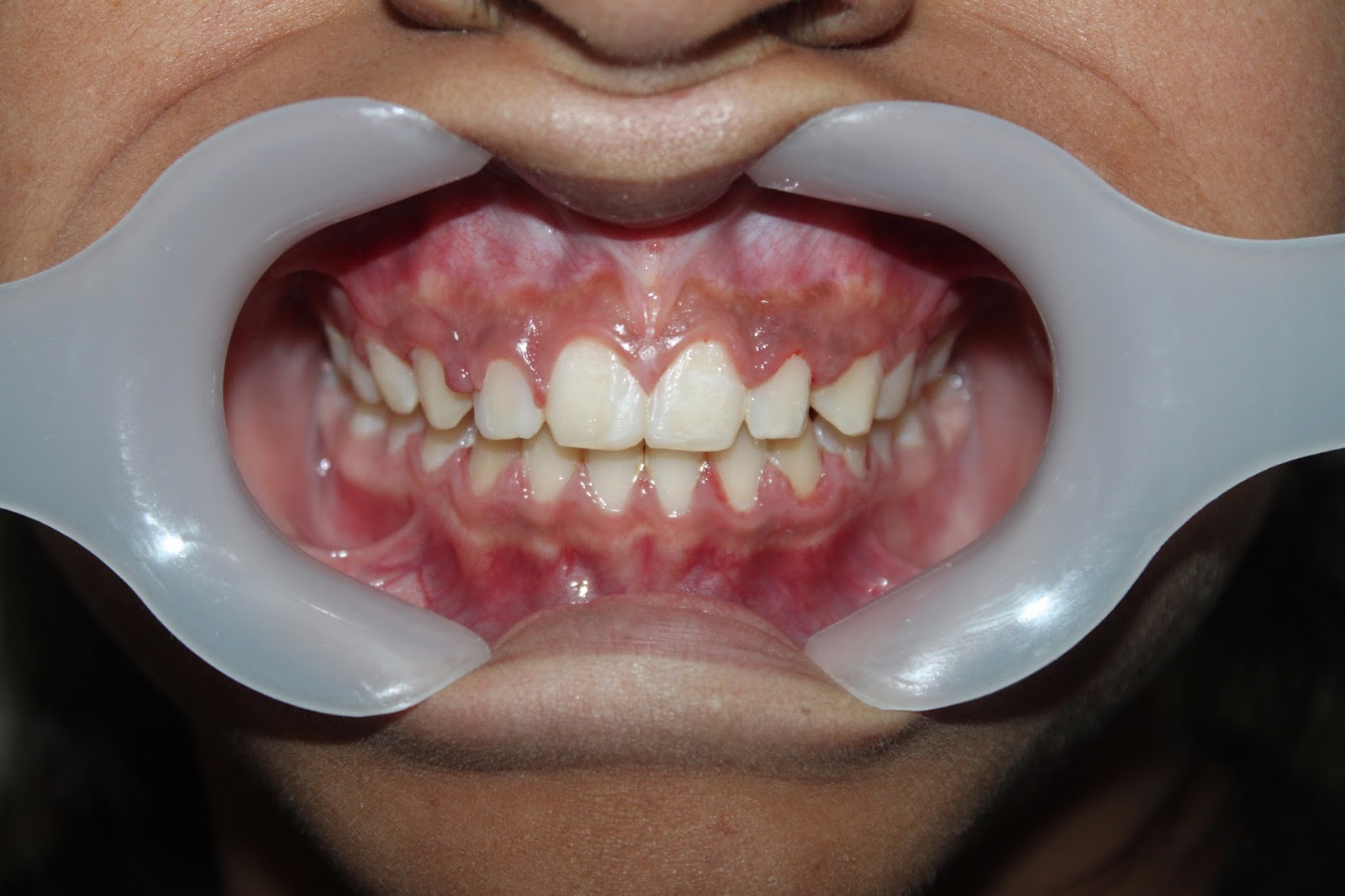 Smiles of San Marcos