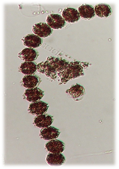 ALEXANDRIUM CATENELLA