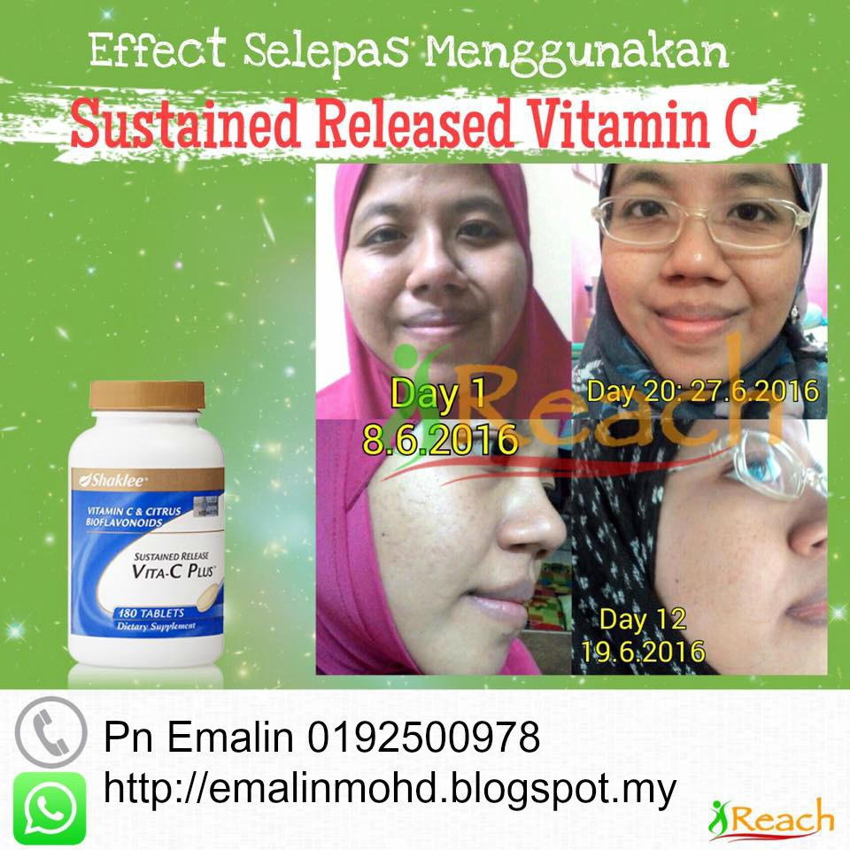 Hilangkan Parut Dan Jerawat Batu Di Muka Dengan Set Bajet Student ...