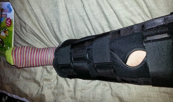 The Brick Castle: Broken knees are rubbish....