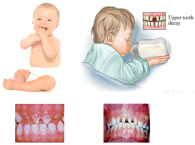 Mommy and Baby: How To Care For Your Kids Teeth (II)