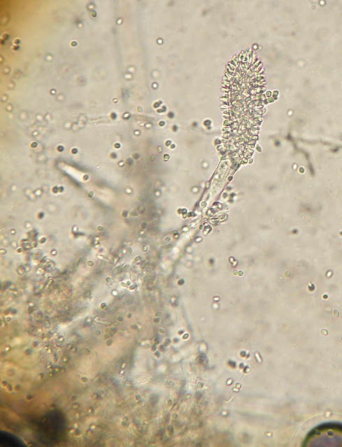 ATLAS MICOLOGIA: ASPERGILLUS CLAVATUS