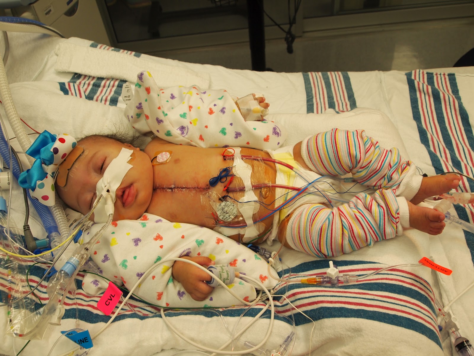 Life As We Know It...: CVICU Day 2