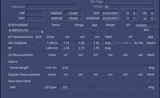Little Star Dragon: 13w4d, ultrasound pictures