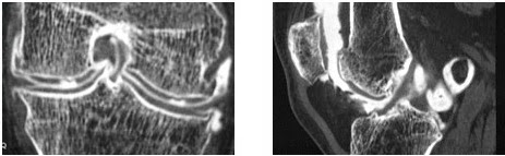 Optativa DDI 2014: Caso discutido em 28/03 - Musculoesqueletico