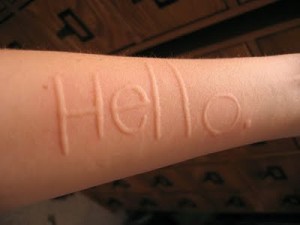 Alerjik Durumlar - Dermografizm / Dermatografizm - Benden ve Bizden