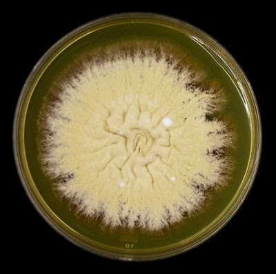 Fun With Microbiology (What's Buggin' You?): Epidermophyton floccosum
