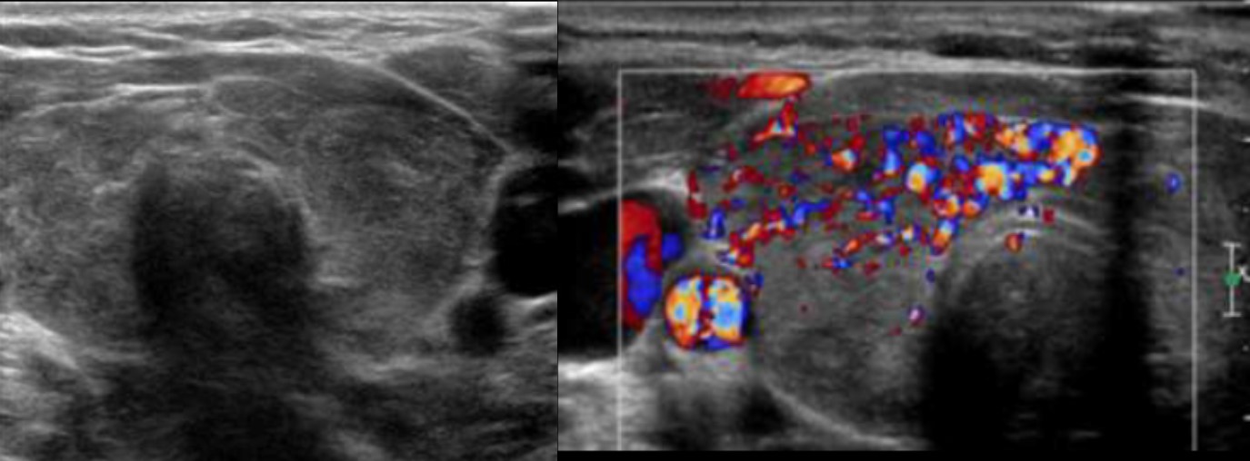 Dokter Nuklir: Saya kan sakit tiroid, kenapa disuruh foto???