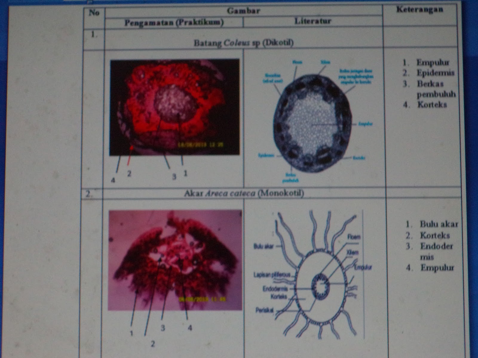 Summervina: [Laporan Mikroteknik] PREPARAT SAYATAN ORGAN TUMBUHAN