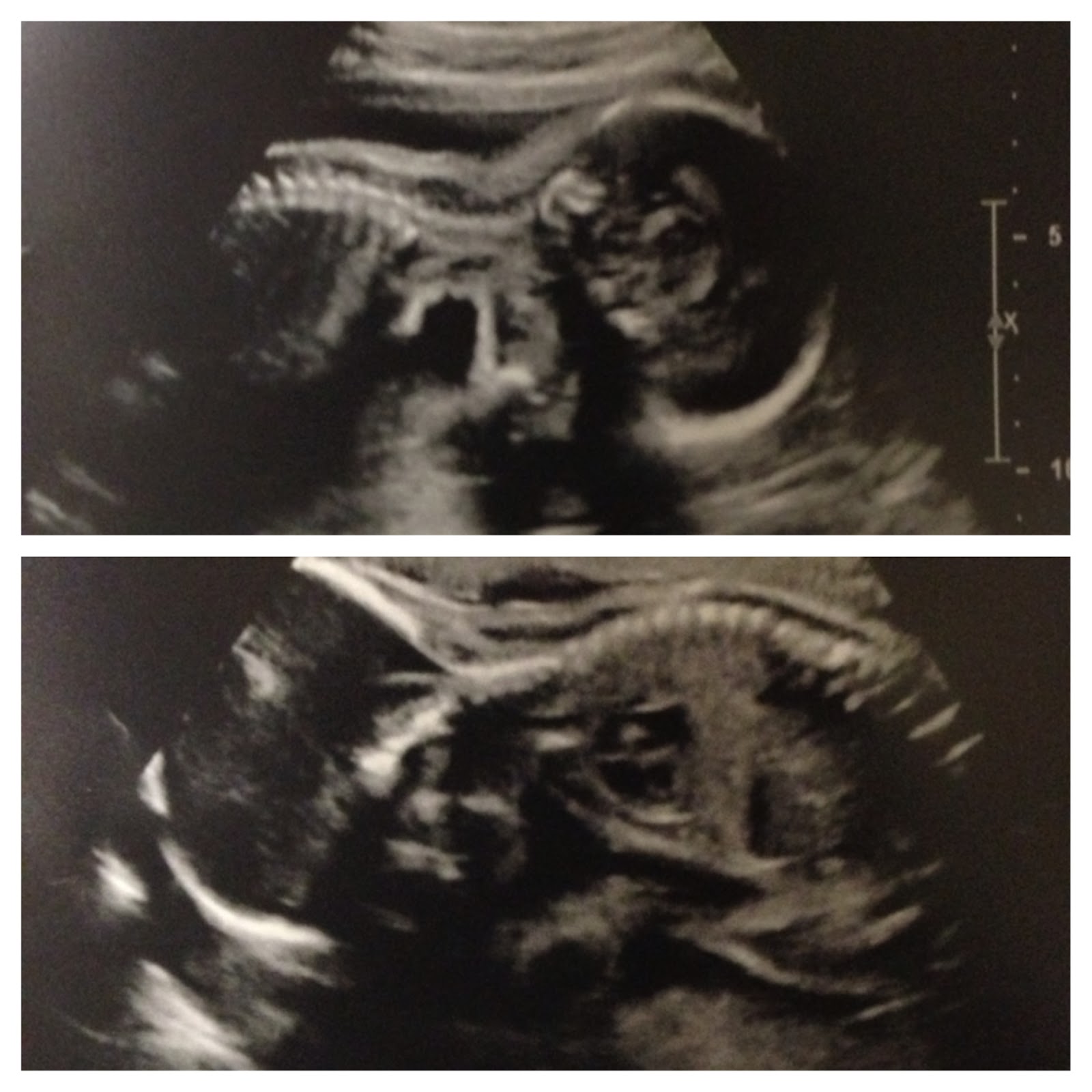 Introducing the Allen Twins: Nov 28, 2013 - 32 weeks 3 days pregnant