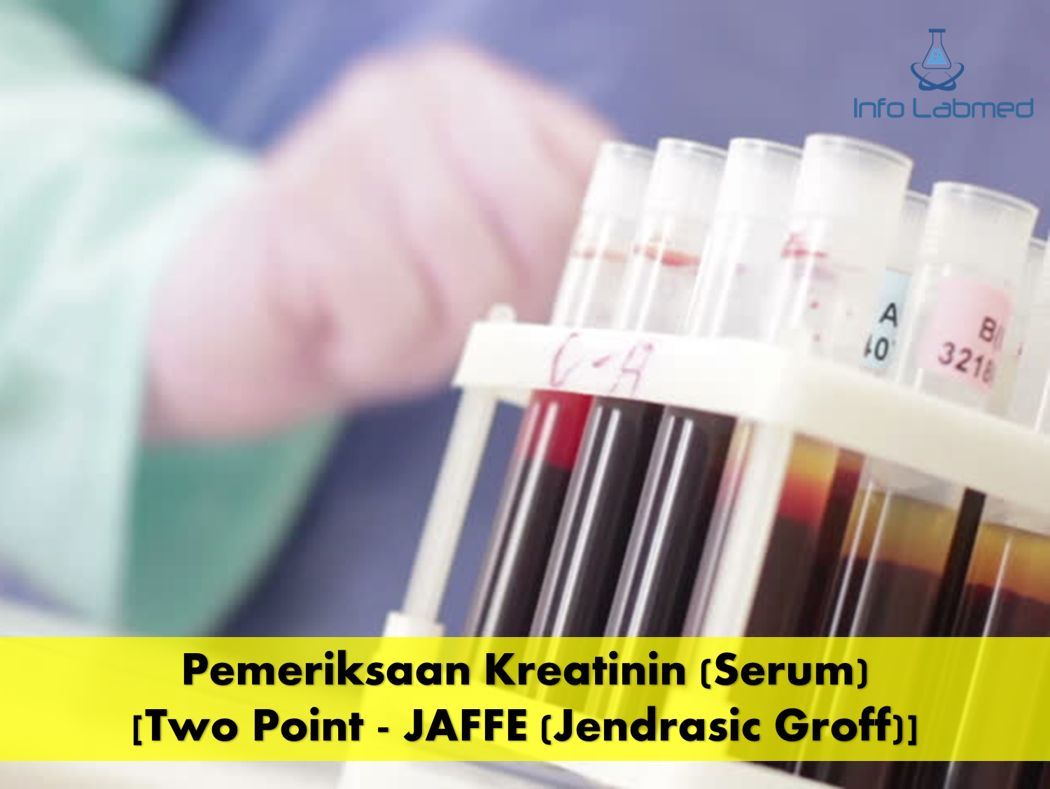 Pemeriksaan Kreatinin (Serum) [Two Point - JAFFE (Jendrasic Groff)]