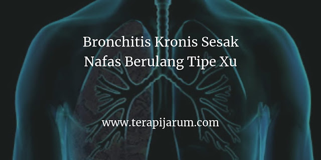 Bronchitis Kronis Sesak Nafas Berulang Tipe Xu - Terapi Jarum