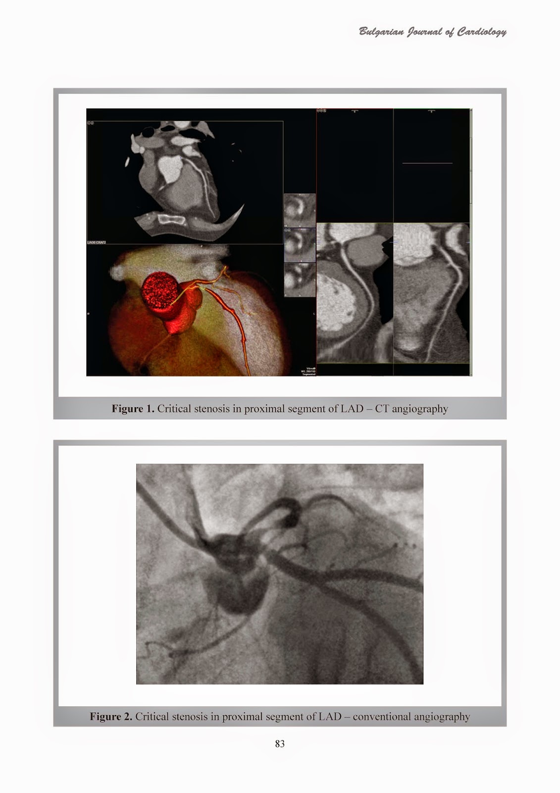BULGARIAN JOURNAL OF CARDIOLOGY: BJC 2/2014 APRIL - JUNE