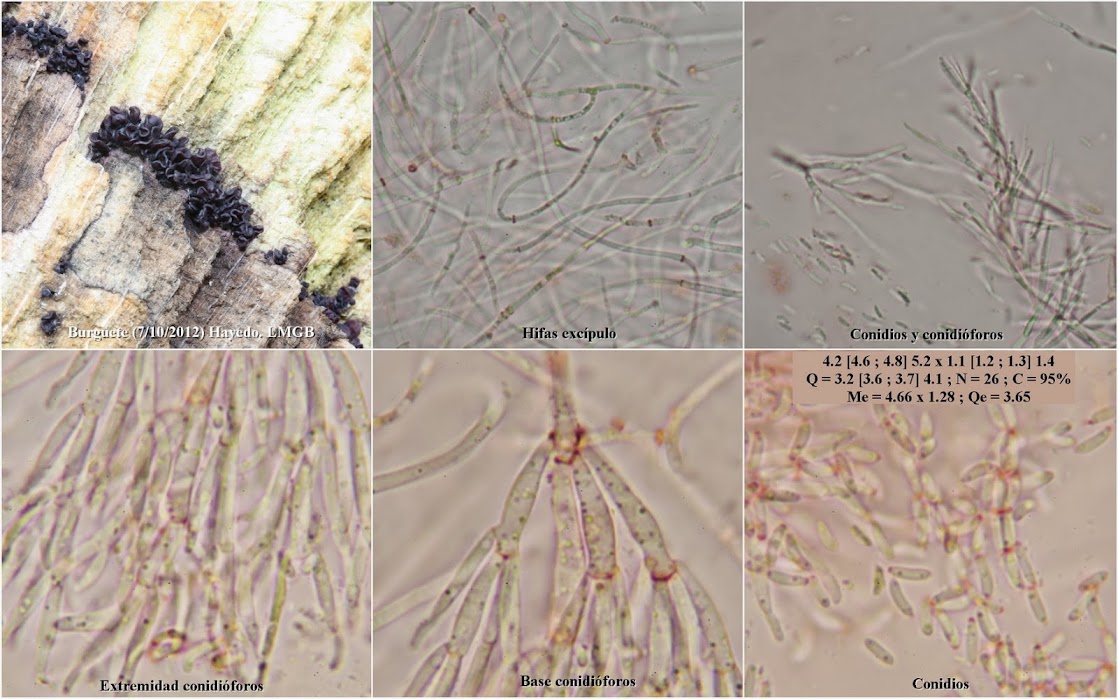 Microscopía de hongos. Vol 1 . A - C: Ascocoryne sarcoides