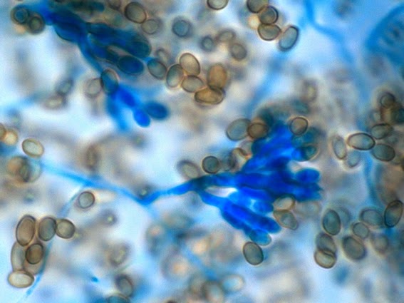 Fun With Microbiology (What's Buggin' You?): Scopulariopsis brumptii