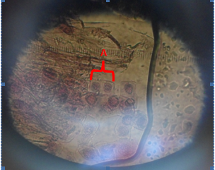 strawberry's diary: Laporan mikroteknik pembuatan preparat squash