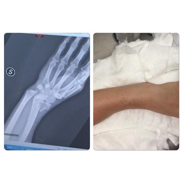 Kojutsukan: FOOSH Revisited