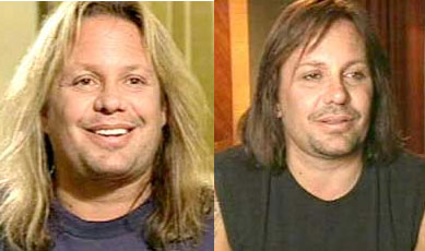 Vince Neil Plastic Surgery Before and After Brow lift, Check Lift and ...