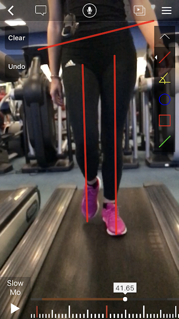 Dynamic Postural Assessment