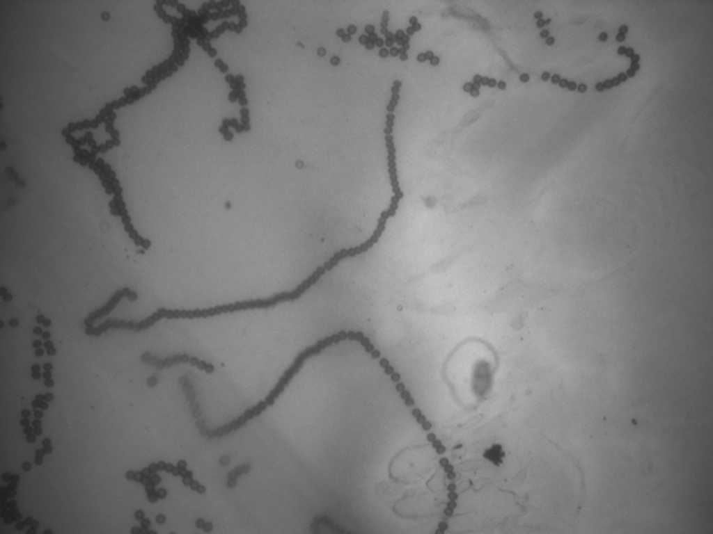 plant pathology 631 lab report: Lab 1 visulization of different fungul ...