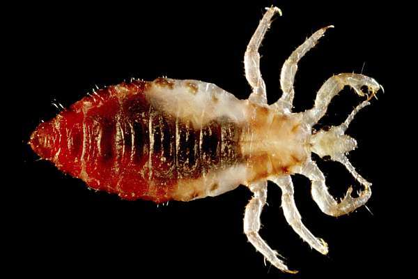 Vivendo e Aprendendo: QUAL O TRATAMENTO PARA ACABAR COM O PIOLHO?