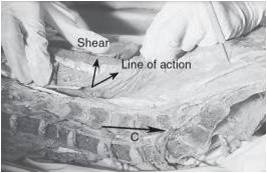 Valoración del movimiento y prescripción de ejercicio: Los subsistemas ...
