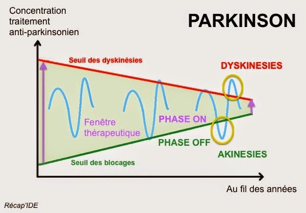 La maladie de Parkinson | Récap' IDE