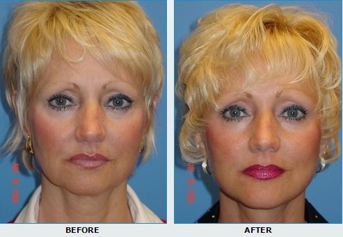 John Sampson, MD - Plastic Surgeon Miami