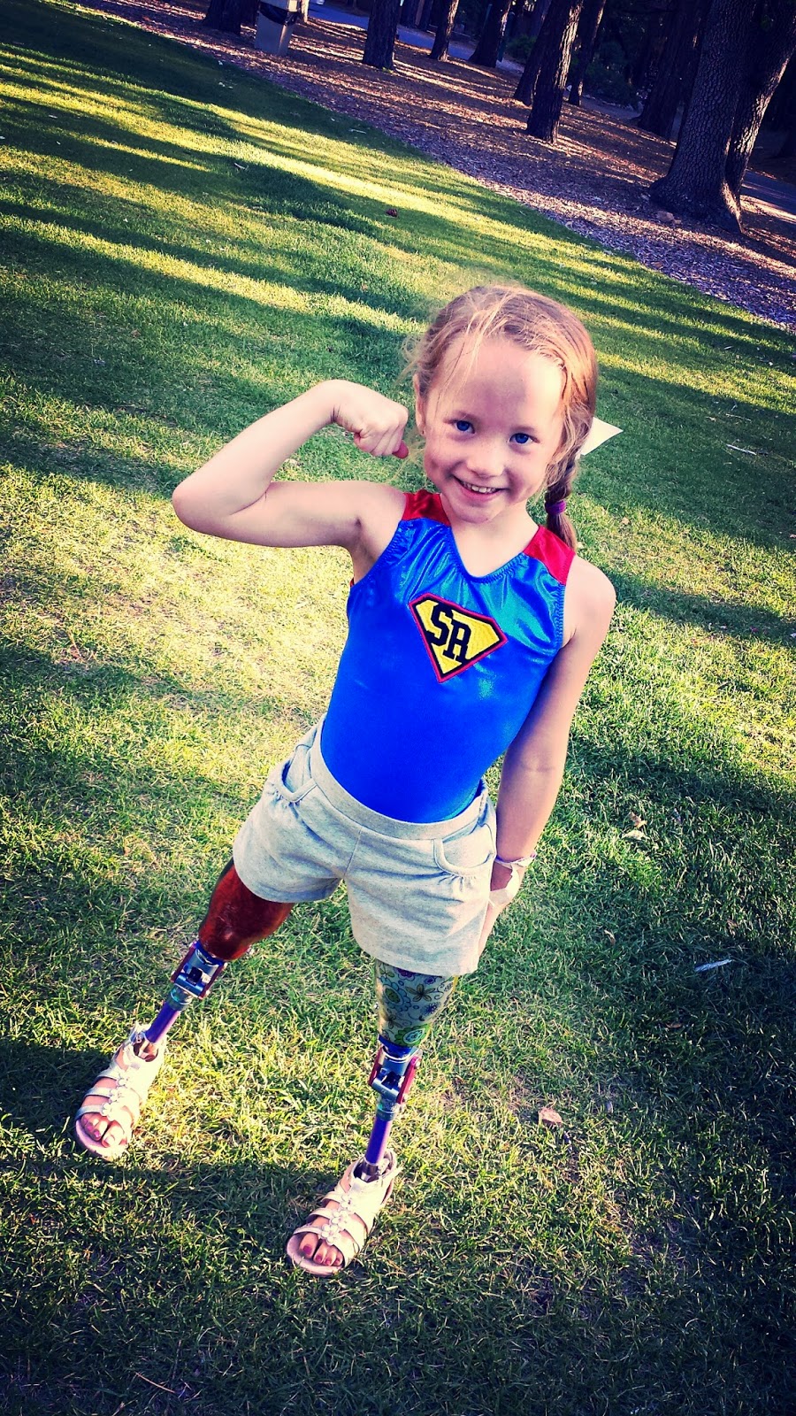 A 6 year old girls journey of becoming a double amputee