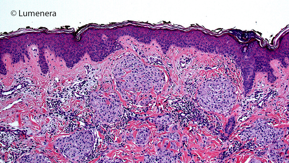 Microscope World Blog: 2016