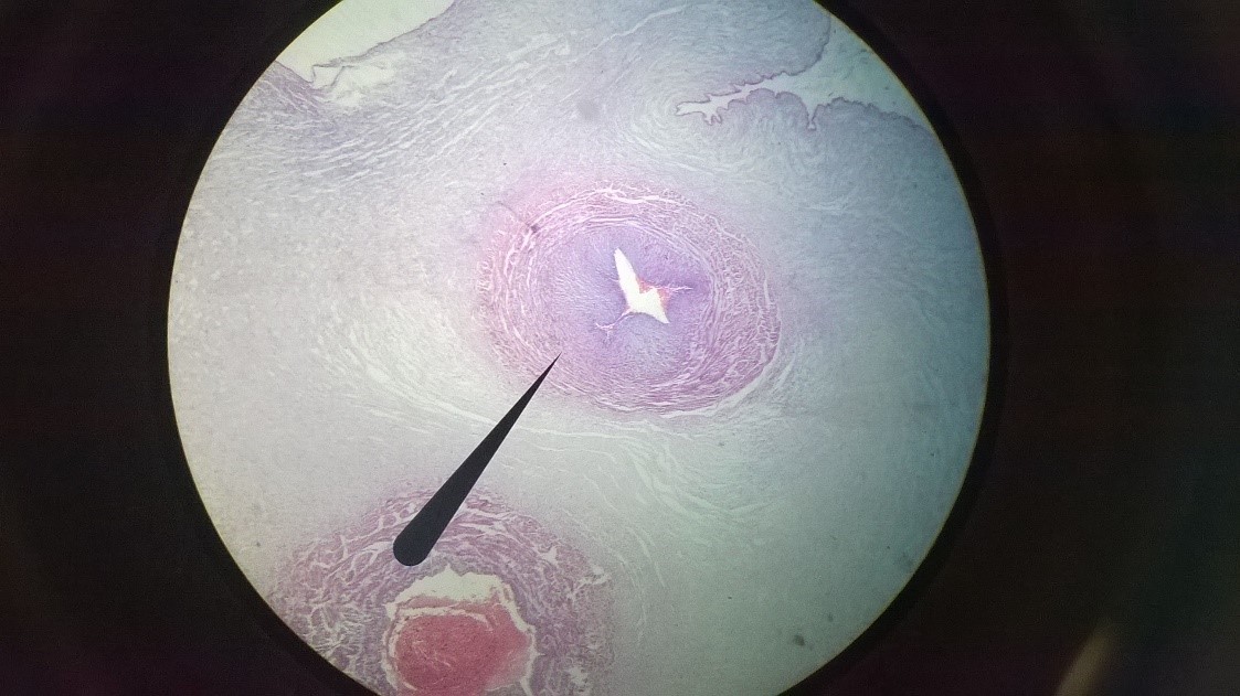 Histología: Tejido Conjuntivo Laxo