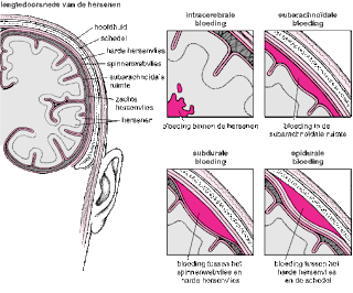 Medische Kennis: Traumatologie: schedel/hersenletsel