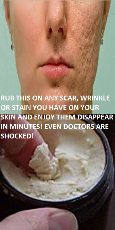 Healthy - centrals: RUB THIS ON ANY SCAR, WRINKLE, OR STAIN ON YOUR ...